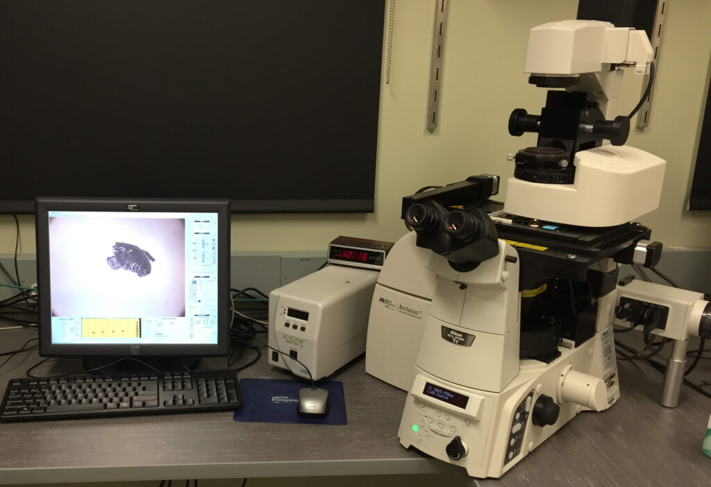 Laser Capture Microdissection (LCM) Core – COR²E – UConn Center for ...